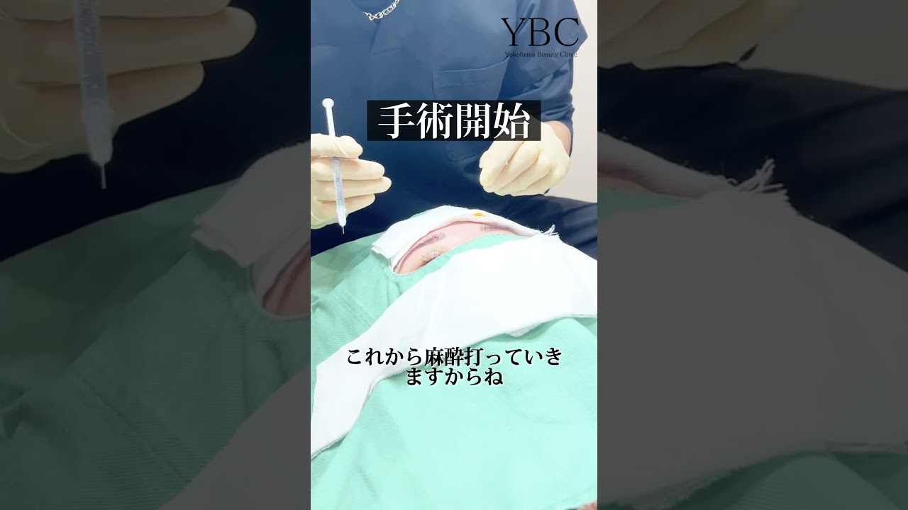 【二重埋没法】広瀬すずに憧れて念願の二重整形！YBC横浜美容外科 #shorts - Moe Zine