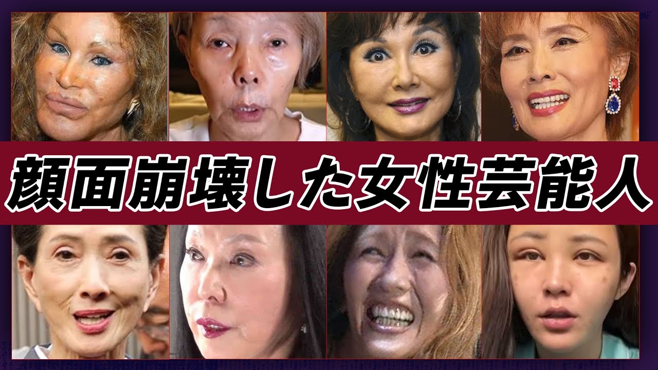 【衝撃画像】顔面崩壊した女性芸能人・有名人25選【※多重整形・整形失敗・事故】 Moe Zine